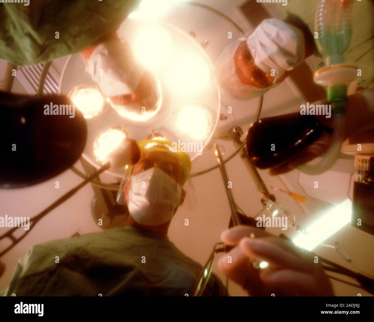 Surgery. Patient-eye-view of an operating team at work in a theatre ...