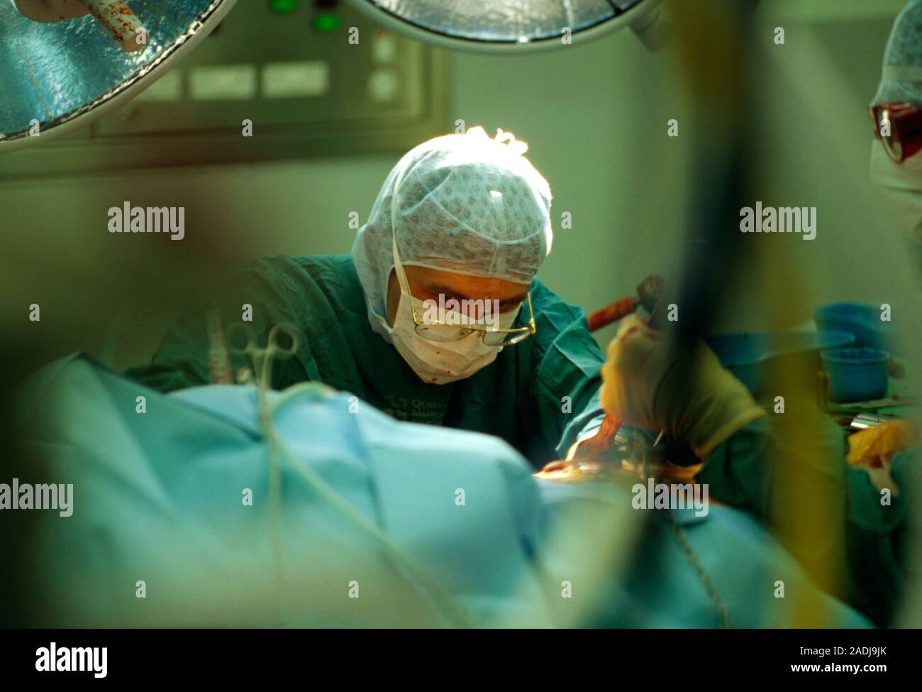 Hip replacement surgery. Surgeon during a hip replacement operation ...