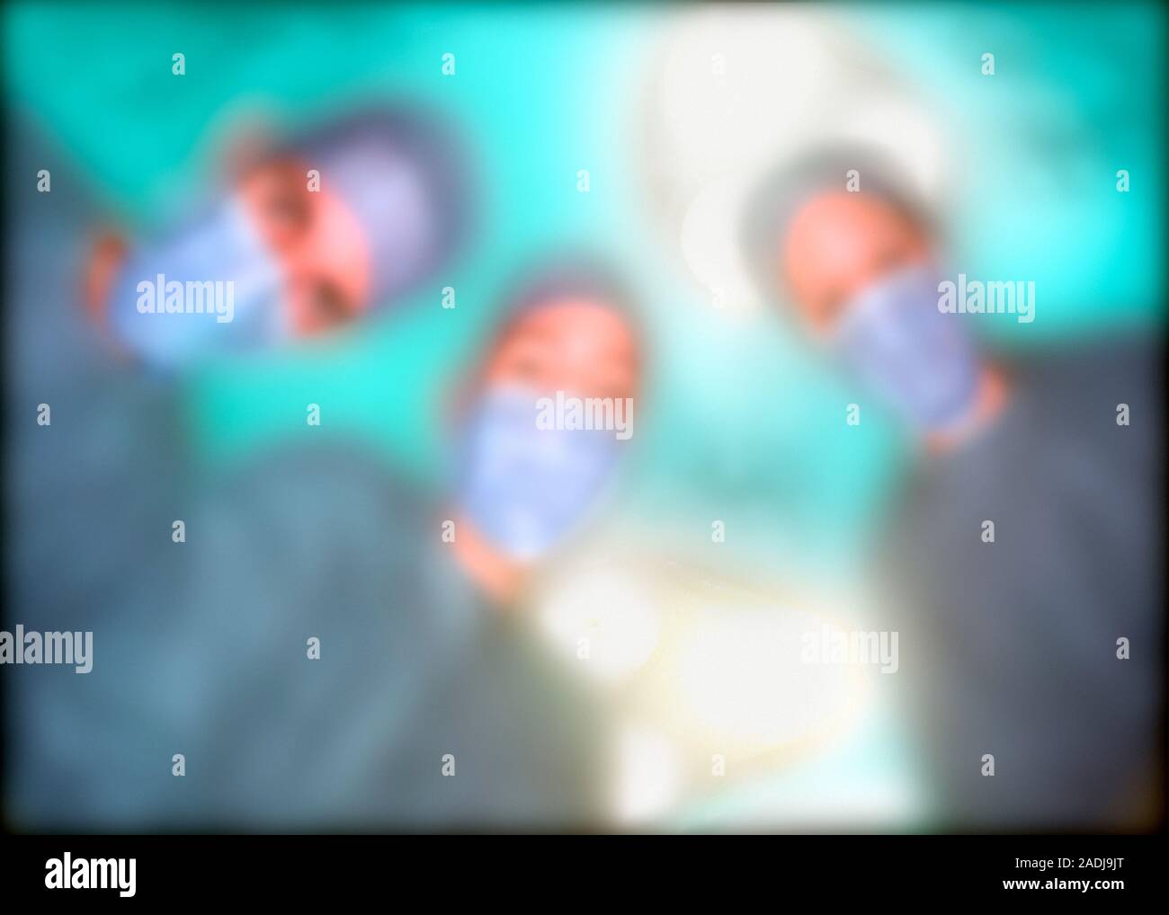 Surgery. Semi-conscious patient's view of a surgical team about to ...