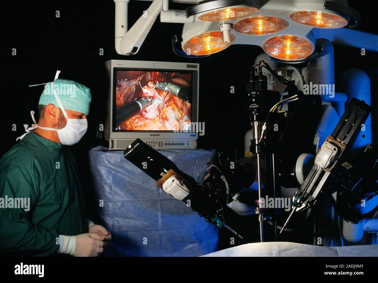 Robot surgery. Surgeon with da Vinci, a remotely-controlled surgical ...