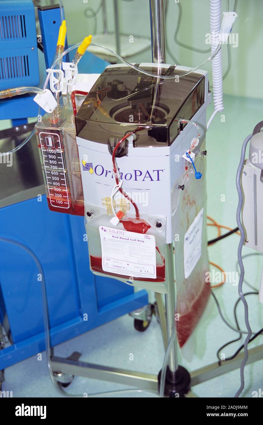 Surgical blood machine. Orthopaedic (bone) surgery blood machine. This ...
