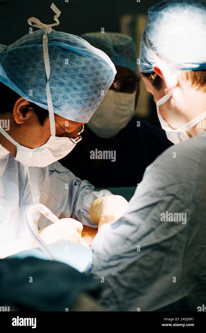 MODEL RELEASED. Surgery. Consultant and his team operating during ...