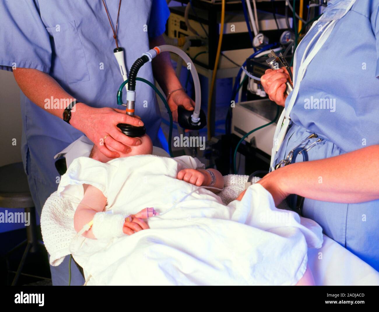 Infant receiving anaesthetic gas through a mask prior to a cardiac ...
