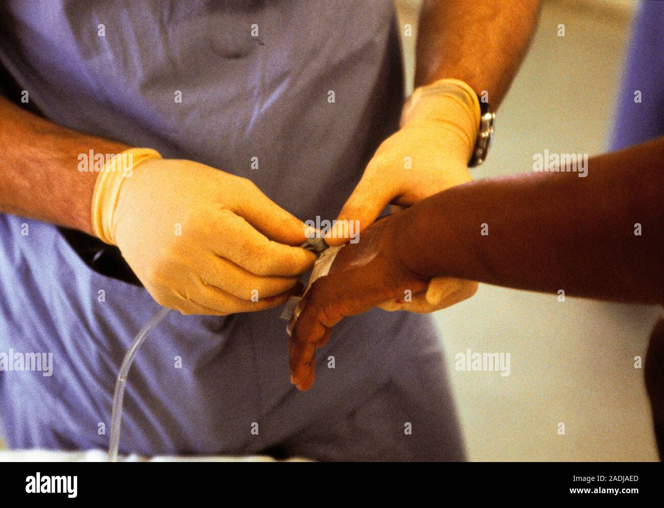 Anaesthesia. Gloved hands of an anaesthetist fitting an intravenous (IV ...