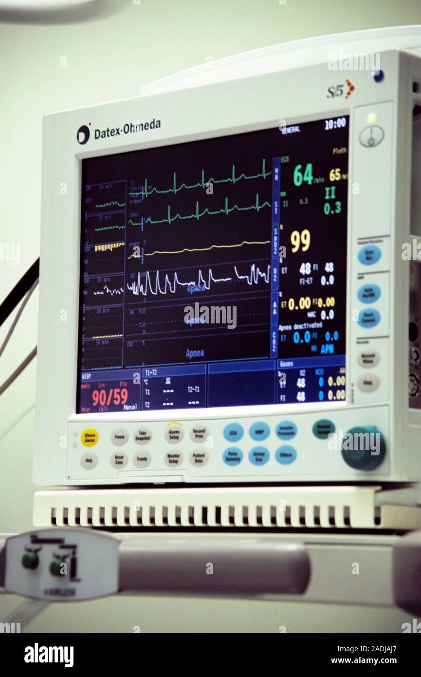 Surgery monitor. This monitor displays the vital signs of a patient ...