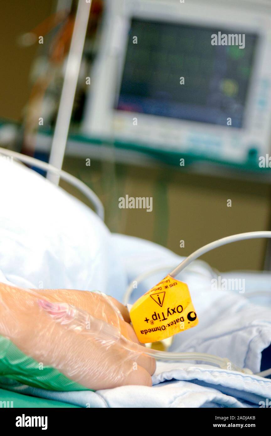 Vital signs monitors. Monitors and cables used to measure a patient's ...