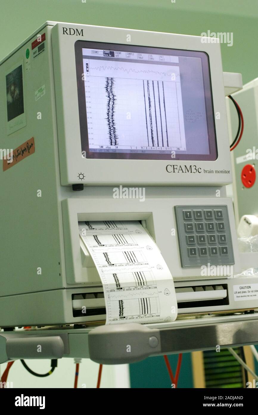 Brain wave monitor in an operating theatre. This machine is used by an ...