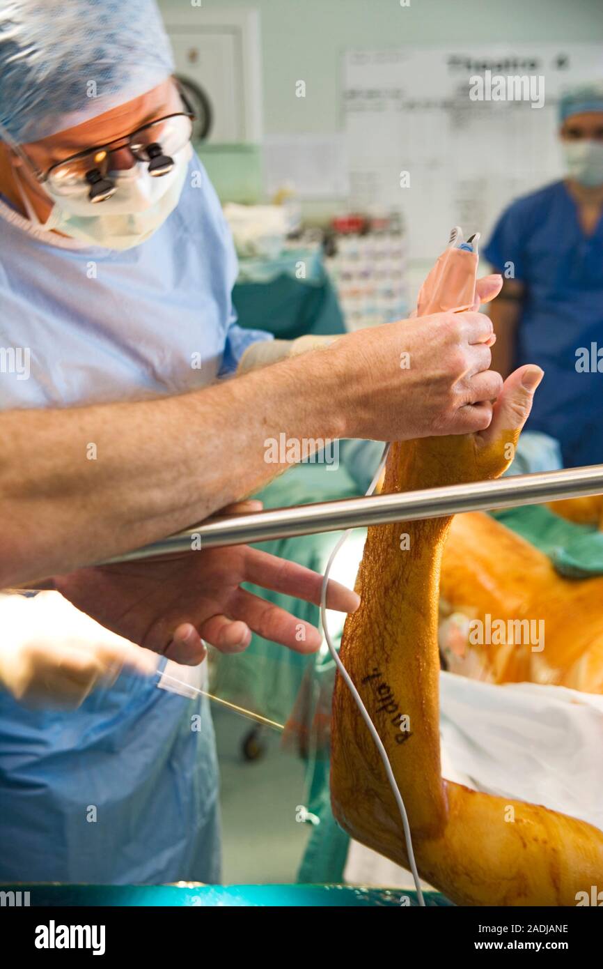 MODEL RELEASED. Checking blood oxygen meter. Anaesthetist checking the ...