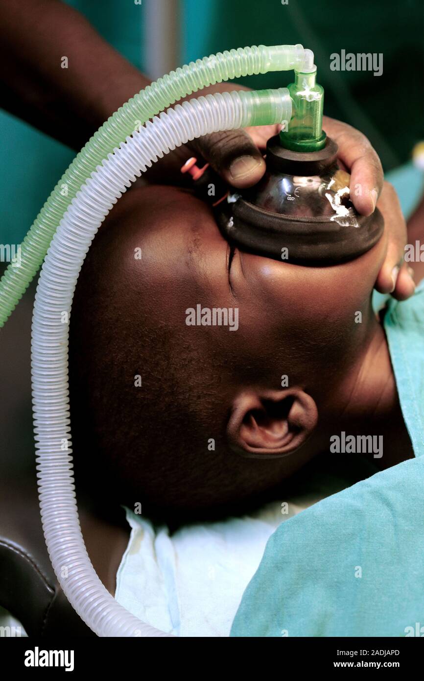 MODEL RELEASED. Anaesthesia. Patient being administered anaesthetic gas ...