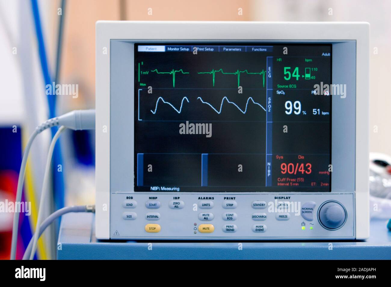 Surgical monitor. The monitor screen displays traces and numbers ...