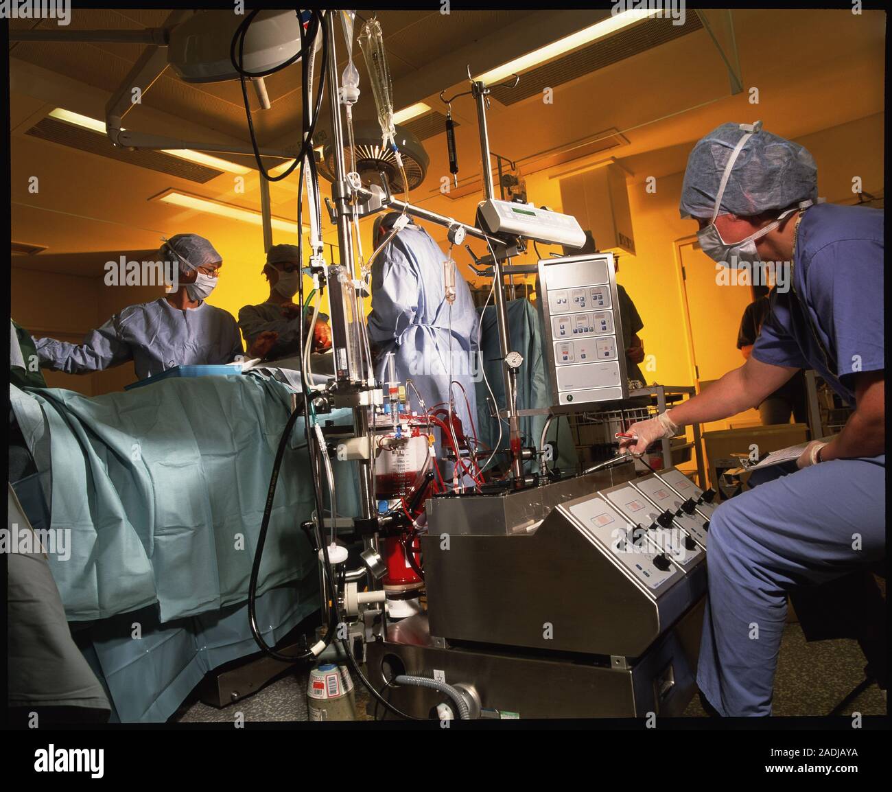 Heart bypass surgery. Masked surgical team perform a triple heart ...