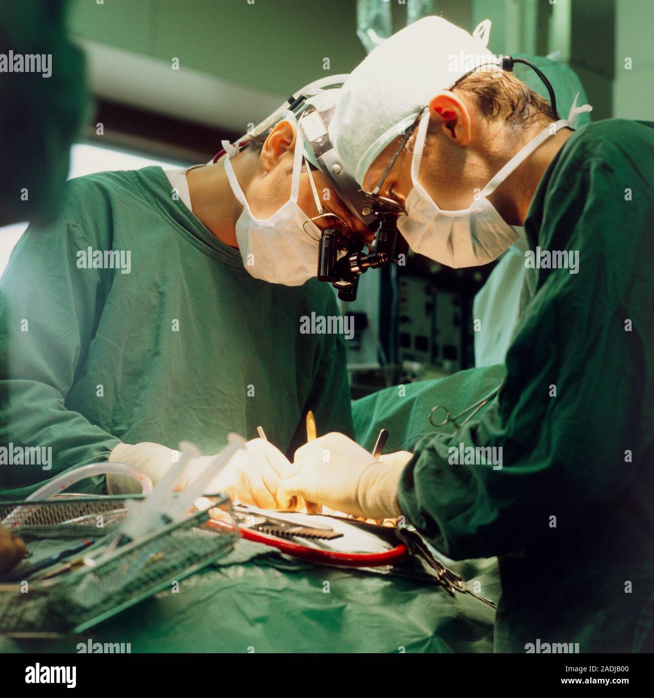Heart microsurgery. View of a two surgeons conducting open heart ...