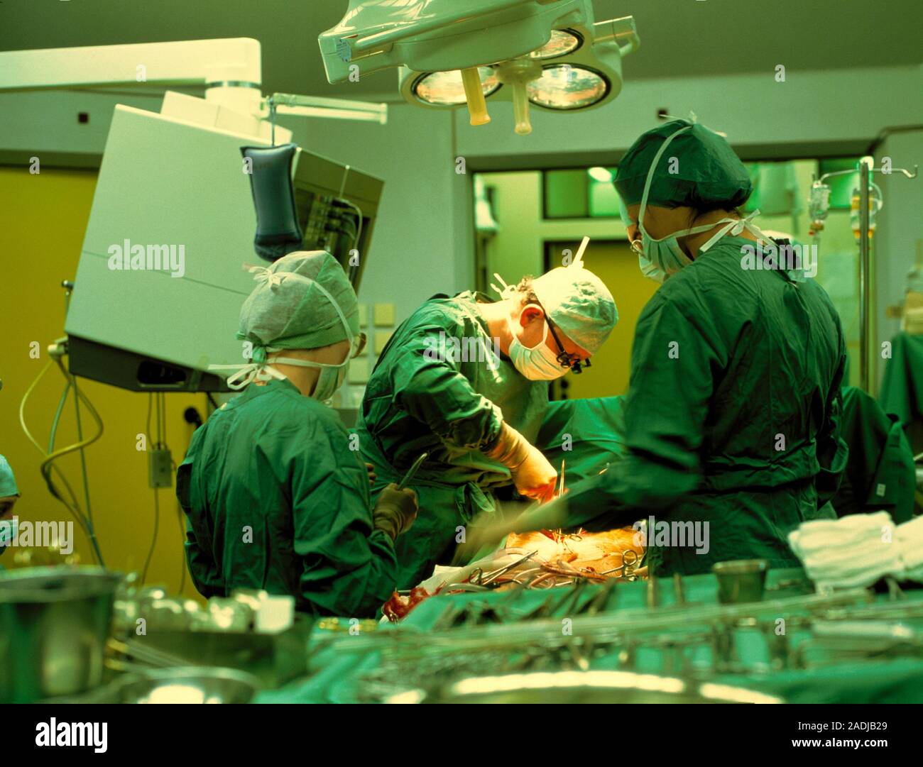 POSED BY MODELS. Heart surgery. Surgical team carrying out open heart ...