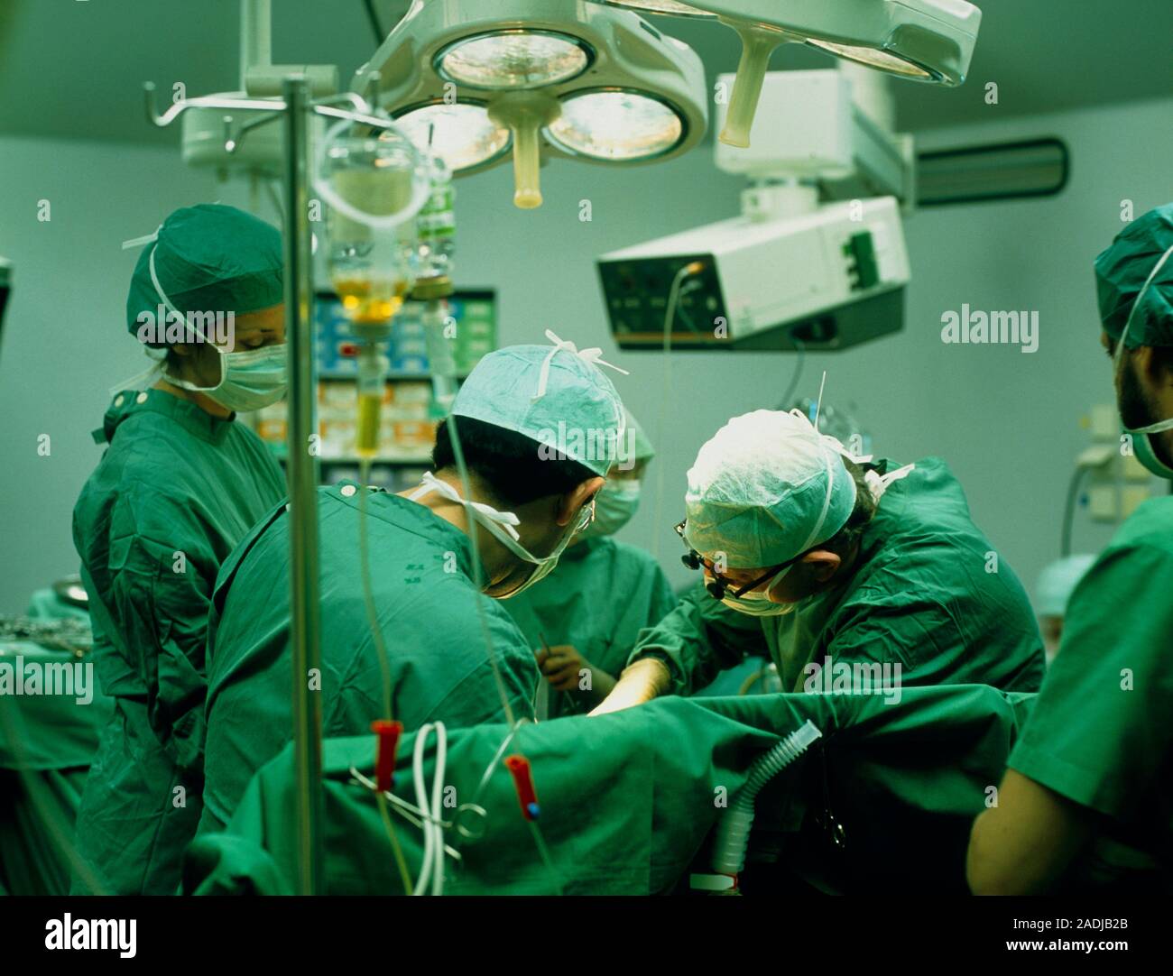 POSED BY MODELS. Heart surgery. Surgical team carrying out open heart ...