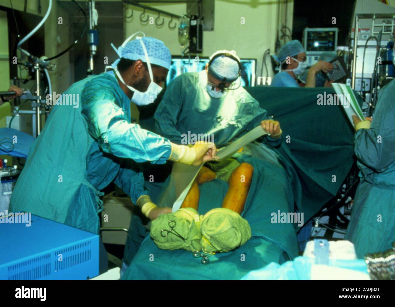 Heart surgery. Medical team laying adhesive drapes onto the legs of a ...