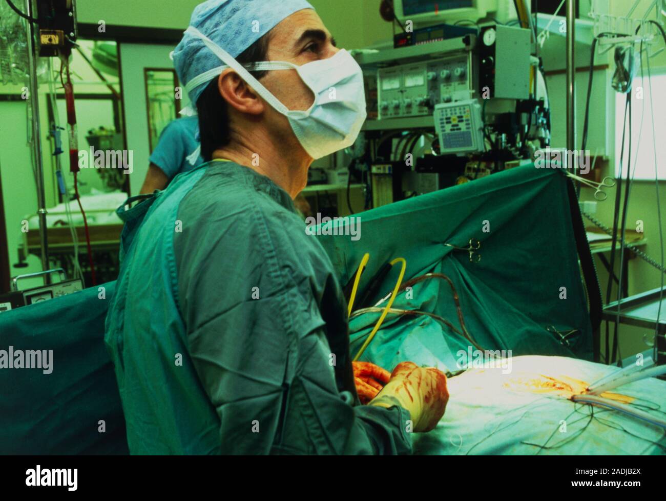 Heart surgery. Surgeon checking on a patient's vital signs following ...