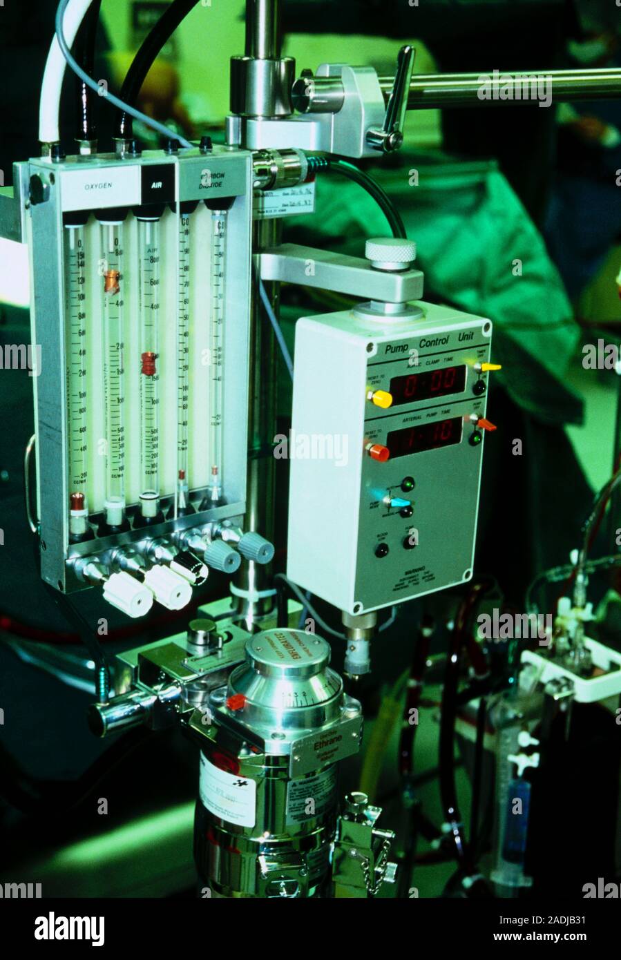 Heart-lung machine during coronary artery bypass surgery. The machine ...