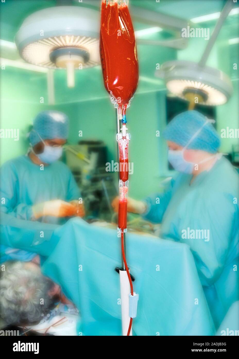 Heart surgery. Surgeon (right) and nurse performing coronary bypass ...
