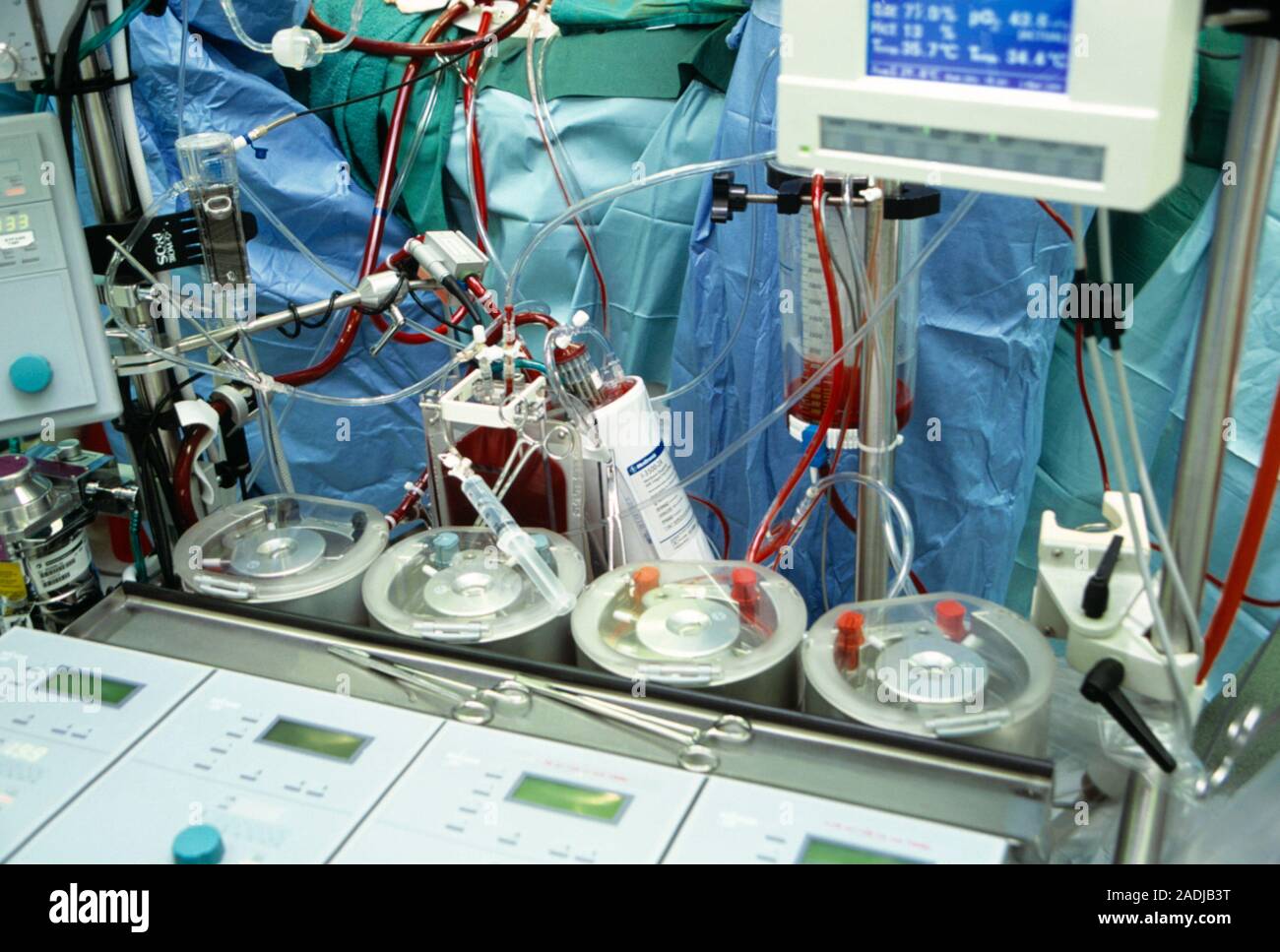 Heart-lung machine. This machine is designed to take over the functions ...