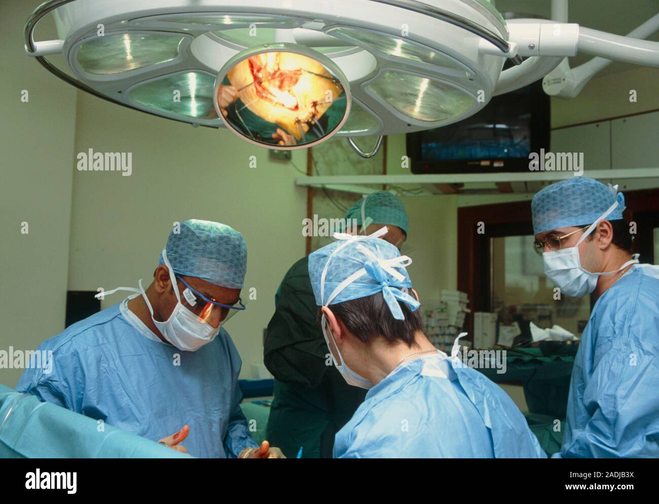 Open-heart surgery. Surgeons closing the chest cavity of a patient at ...