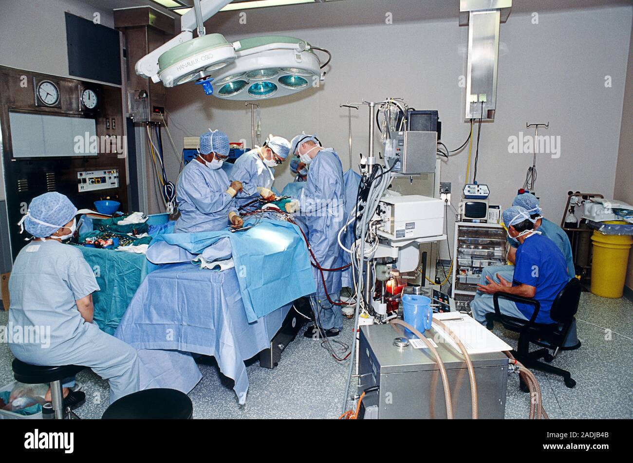 Heart surgery. Patient undergoing cardiac surgery. During the operation ...