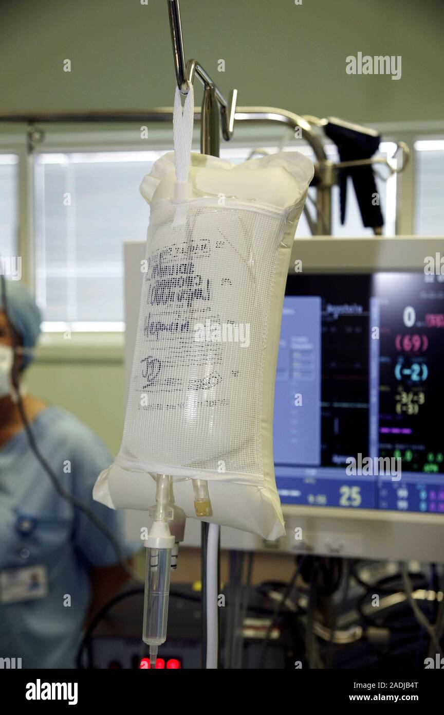 Heart surgery saline bag containing the anticoagulant drug heparin. The ...