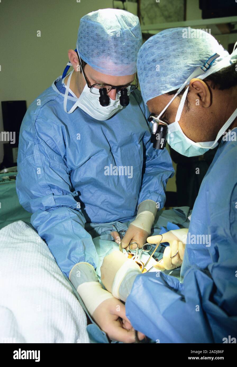 MODEL RELEASED. Heart surgery. Two surgeons preparing blood vessels in ...