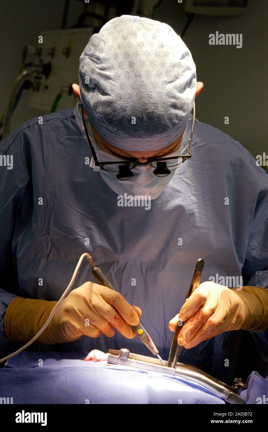 MODEL RELEASED. Heart surgery. Image 5 of 24. Surgeon using a cautery ...