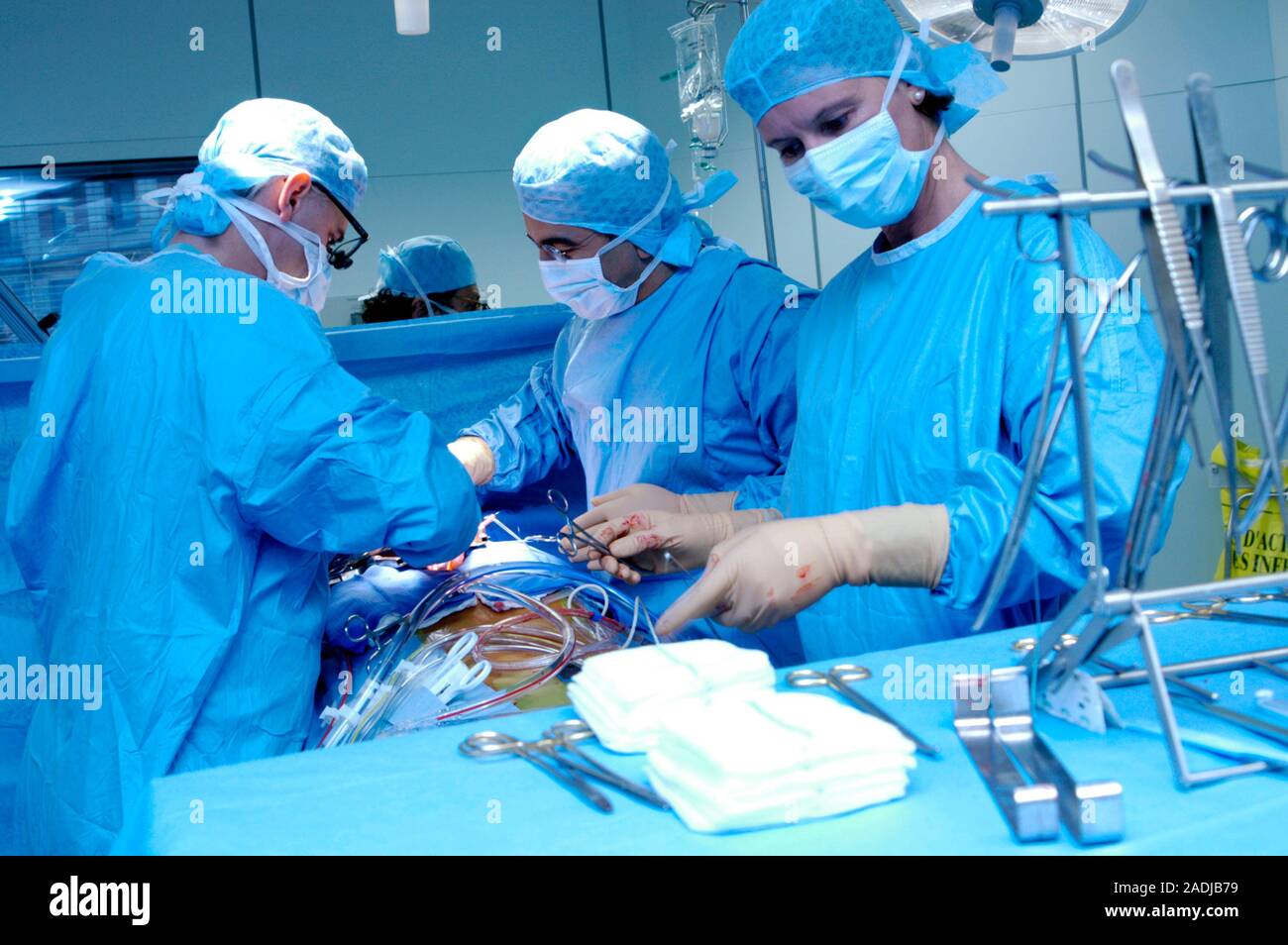 MODEL RELEASED. Heart surgery. Image 10 of 24. Surgeons attaching a ...