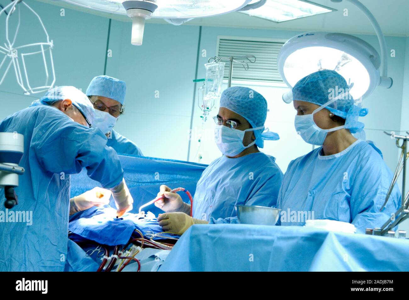 MODEL RELEASED. Heart valve surgery. Image 21 of 24. Surgeons attaching ...