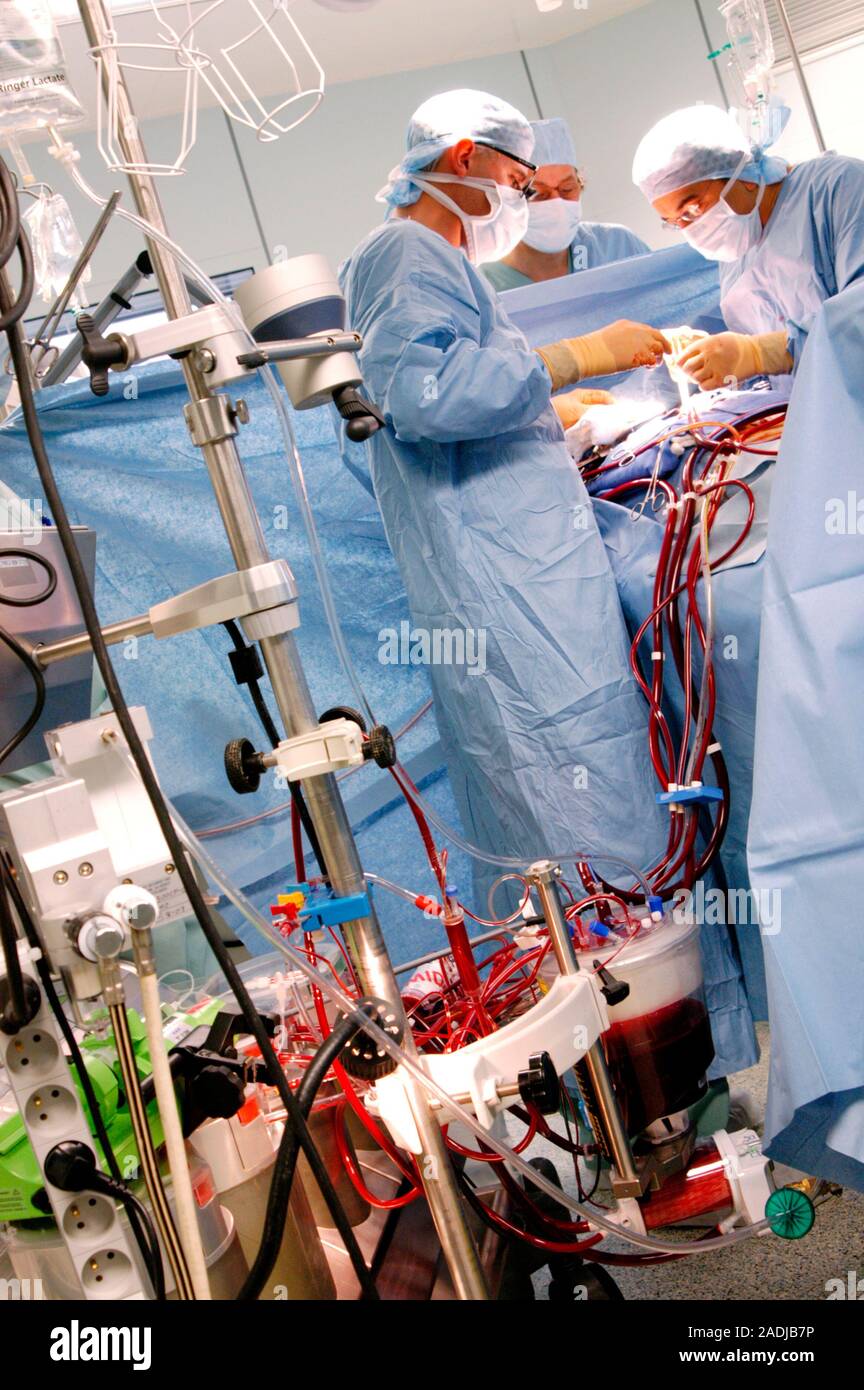 MODEL RELEASED. Heart valve surgery. Image 23 of 24. Surgeons ...