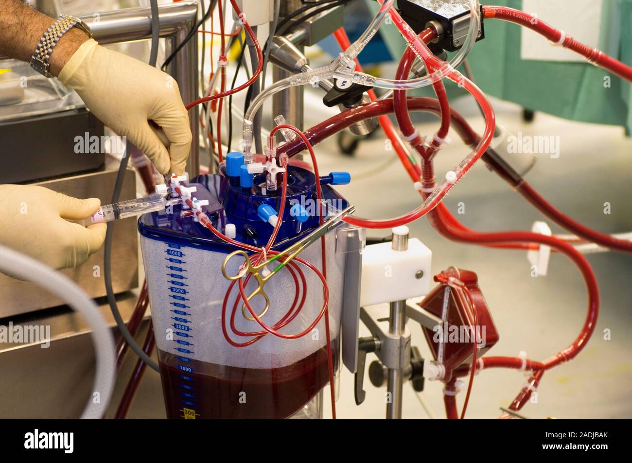 MODEL RELEASED. Heart-lung machine. Nurse using a syringe to introduce ...