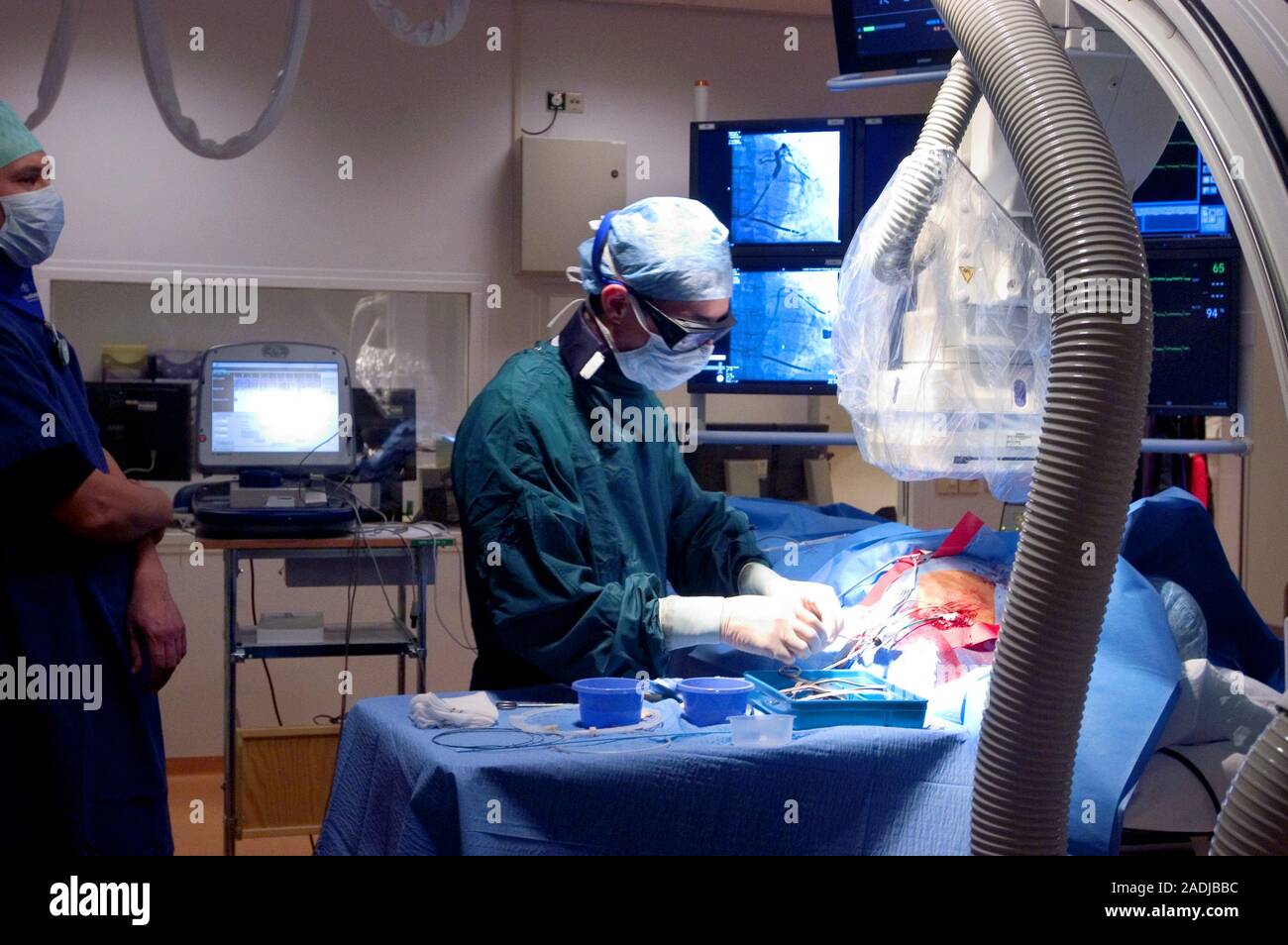 Keyhole heart surgery. Image 1 of 2. Surgeon assessing a patient's ...