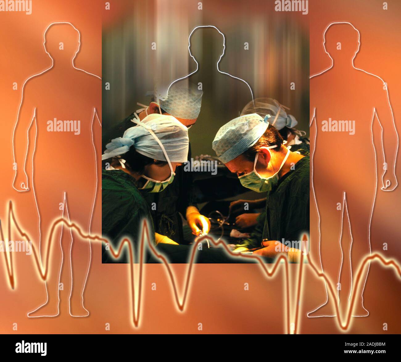 Heart surgery, conceptual artwork. Composite of surgeons performing ...