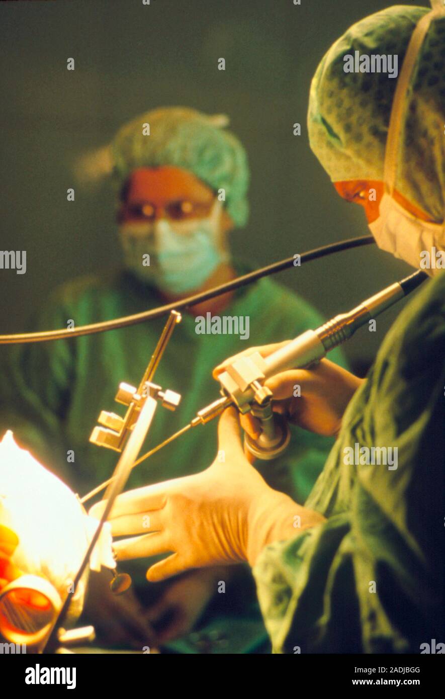 Brain biopsy. Neurosurgeon conducts an aspiration biopsy of brain ...