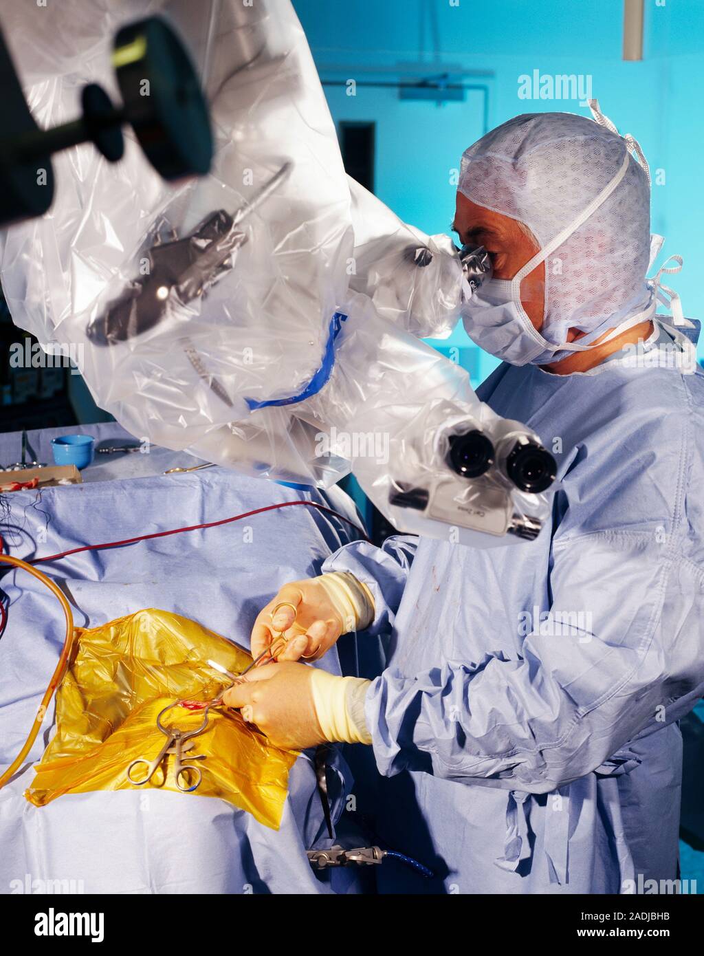Brain surgery. Neurosurgeon performing microsurgery on the brain of a ...