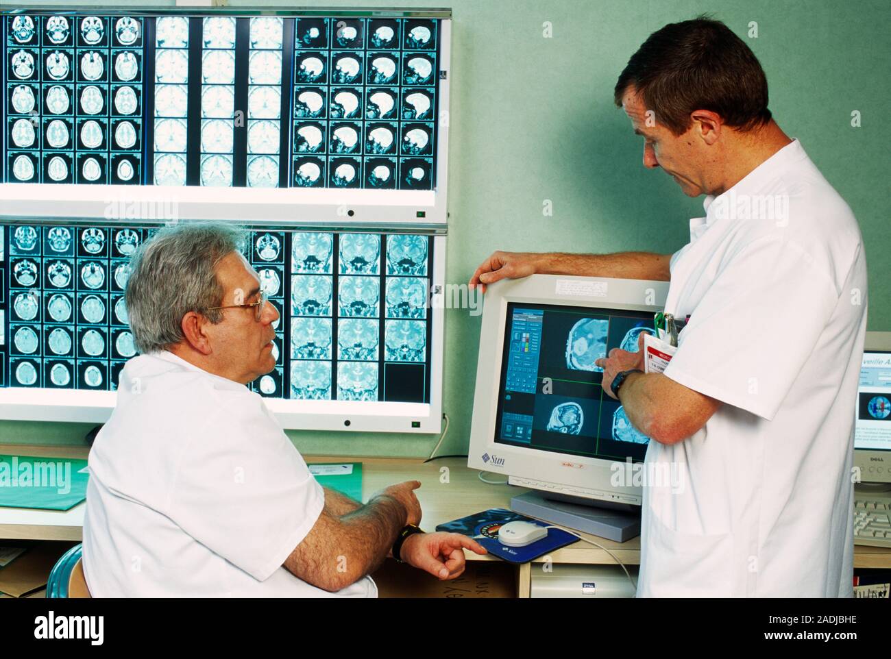Computer-aided brain surgery. Surgeons planning an operation to remove ...