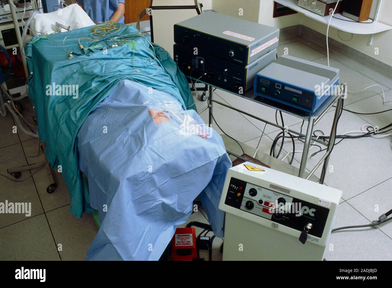 Eye operation. A patient awaits eye surgery on an operating table in a ...