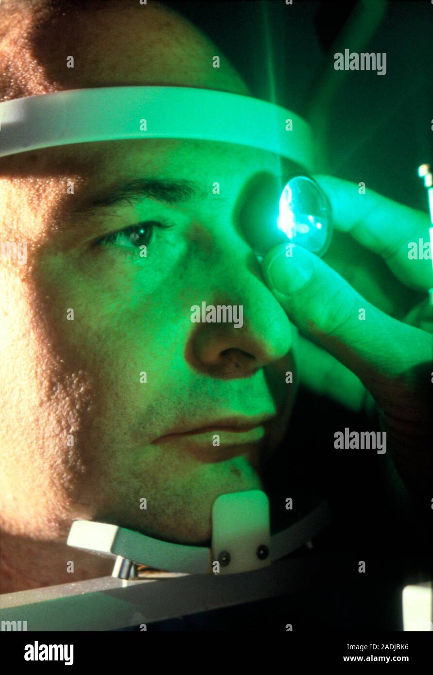 Pre-operative eye examination. Head of a male patient undergoing an eye ...