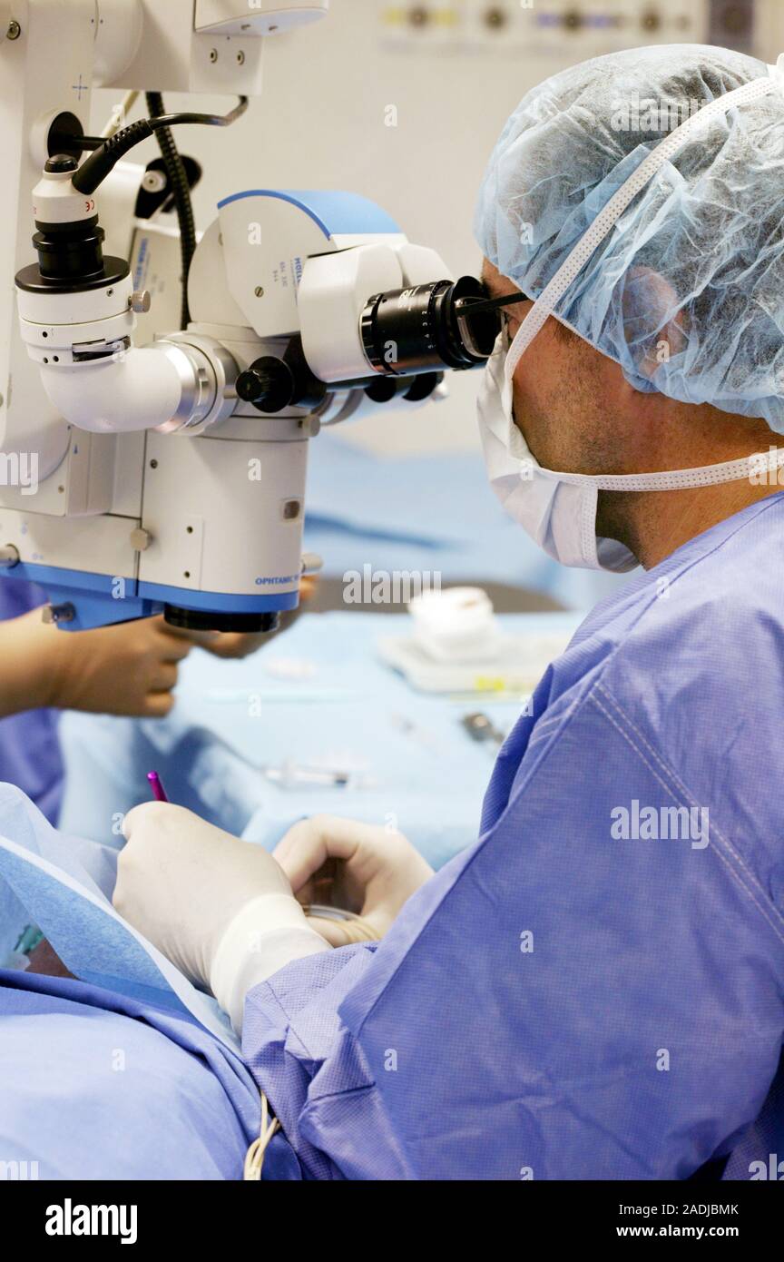 MODEL RELEASED. Cataract surgery. Surgeon using a microscope during ...