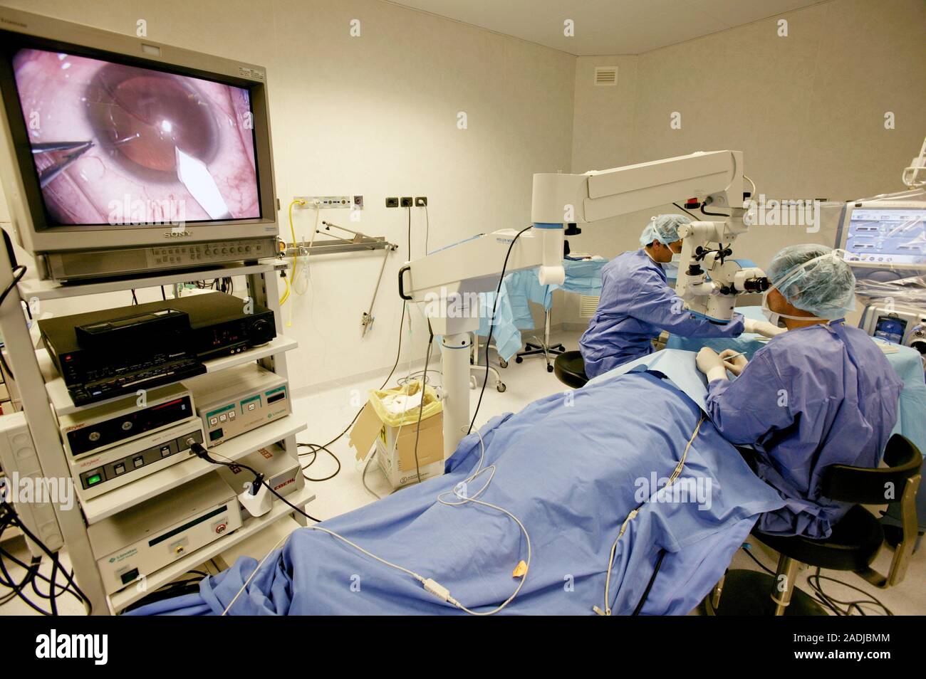 MODEL RELEASED. Cataract surgery. Surgeon (centre right) using a ...