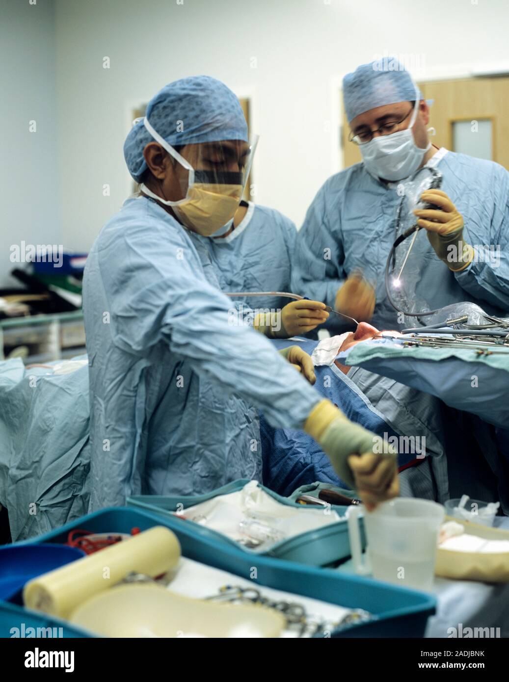 Nasal polyp surgery. ENT surgeon (right) being handed a microdebrider ...