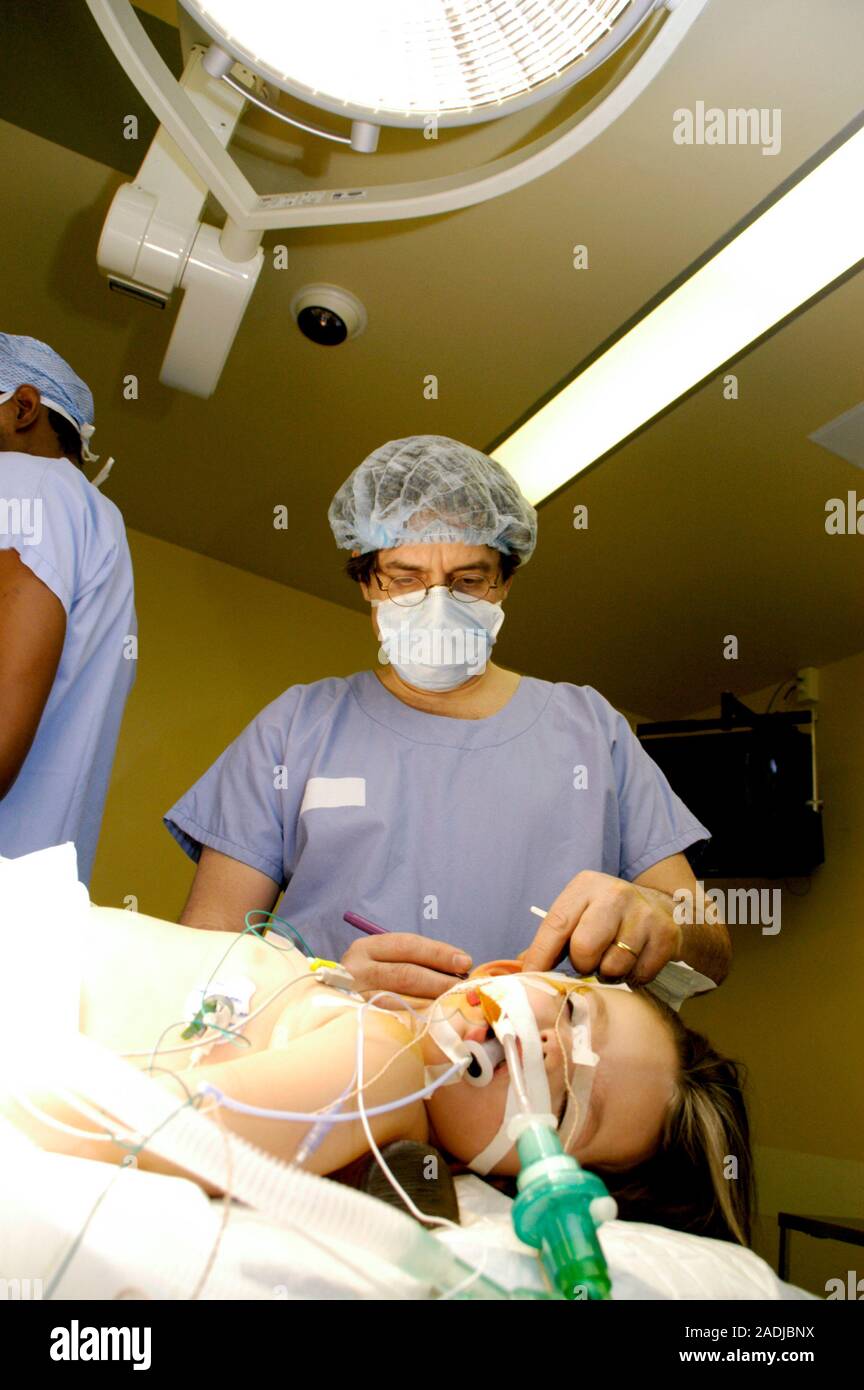 Cochlear implant surgery. Surgeon operating on a 5-year-old girl who is ...