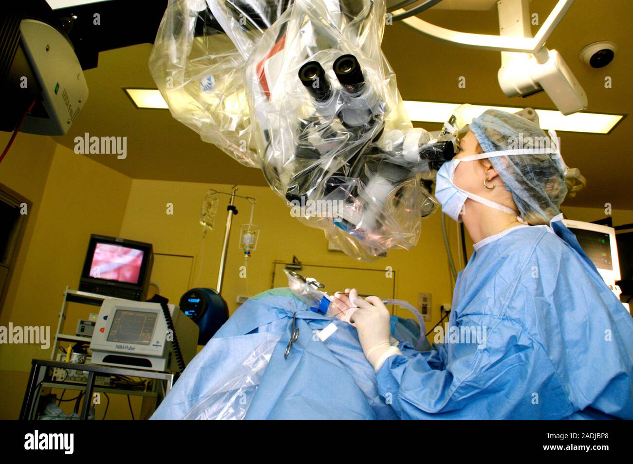 Cochlear implant surgery. Surgeon using a microscope during cochlear ...