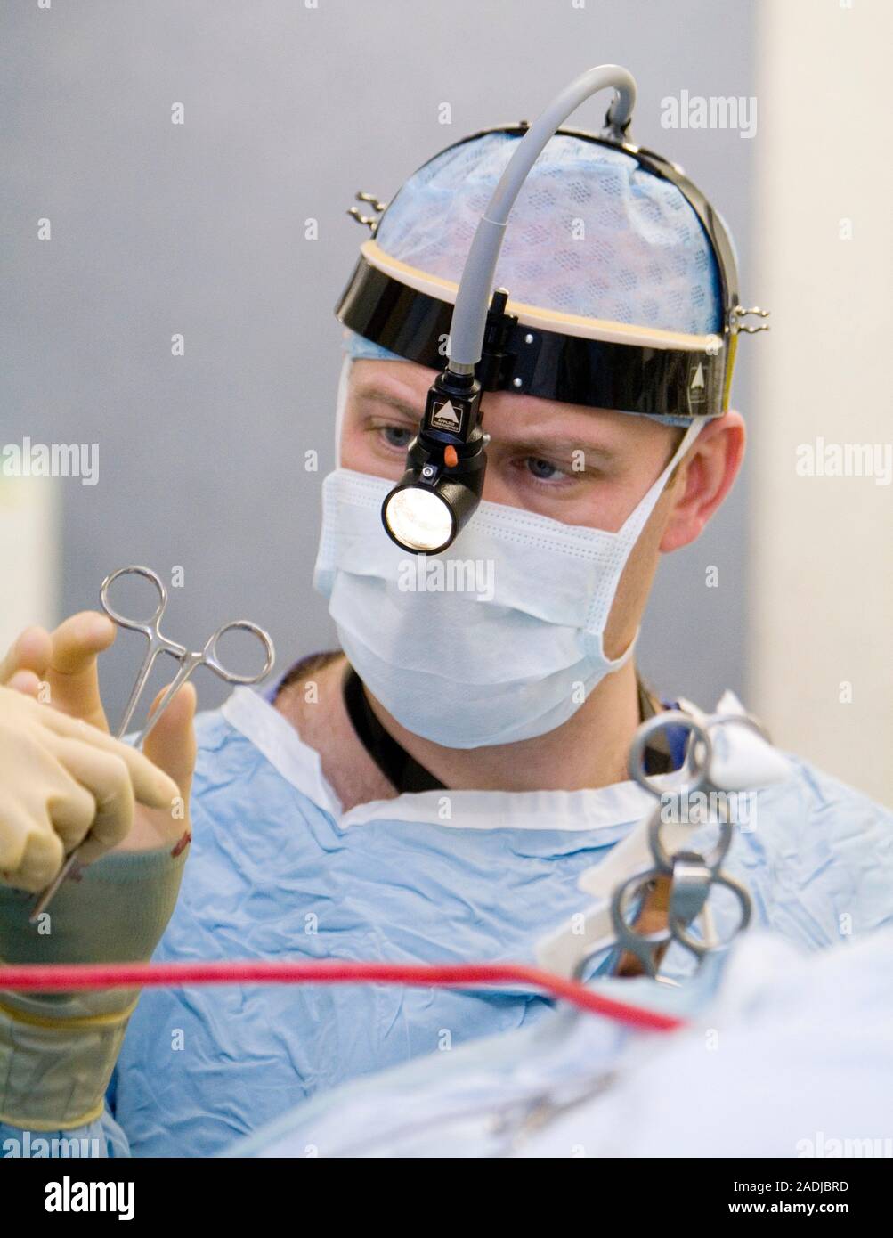 Tonsillectomy. Surgeon performing a tonsillectomy (tonsil removal ...