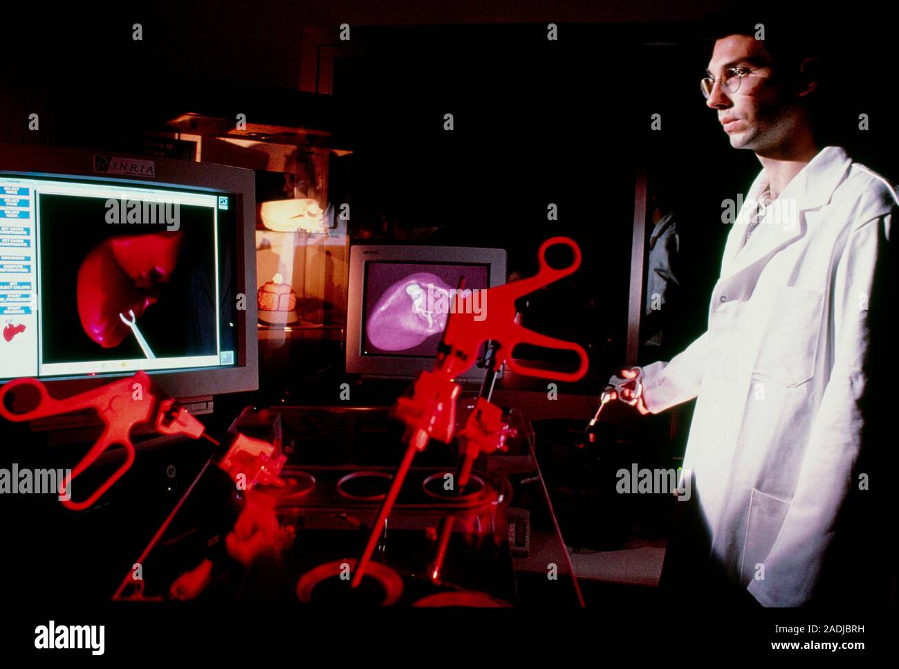 Virtual liver surgery. Technician operates remote callipers during a ...