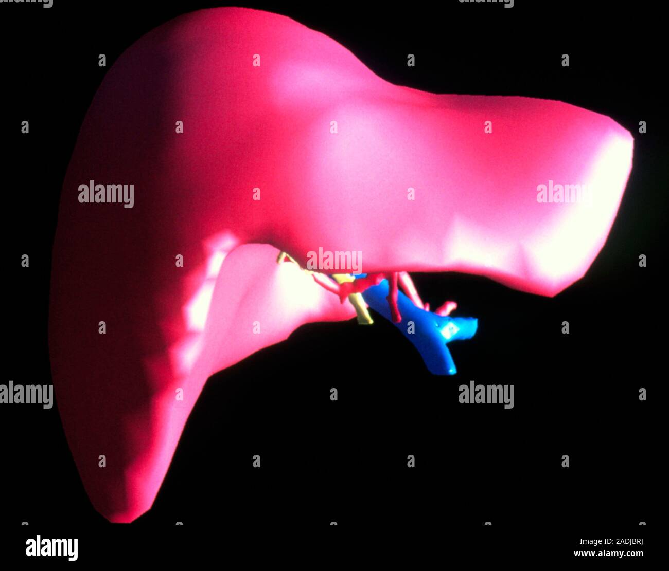 Virtual liver surgery. Three-dimensional virtual reality (VR) image of ...