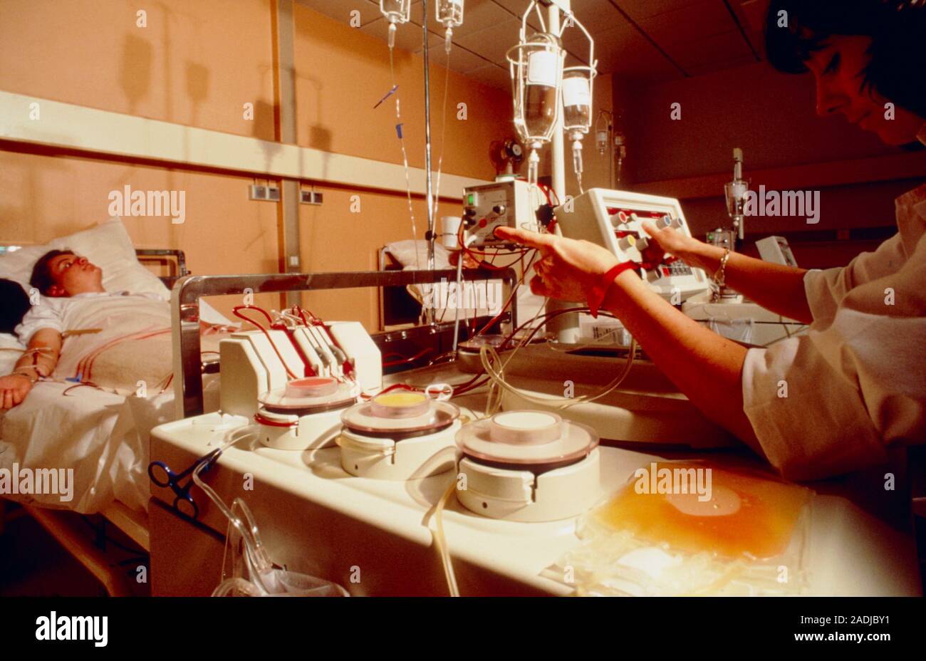 Bone marrow transplant: patient receiving a bone marrow infusion at the ...