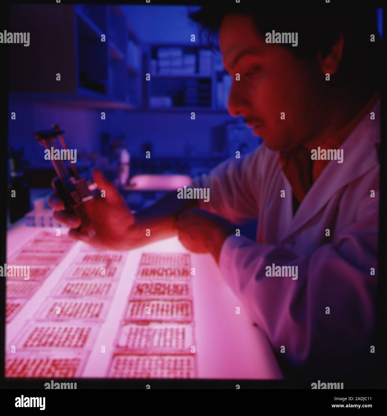 Tissue compatibility test. Tech- nician using a multi-channel pipette ...