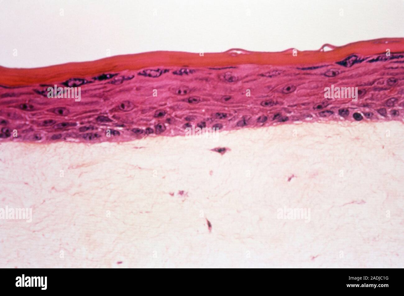 Artificial skin. Light micrograph of a section through the first ...